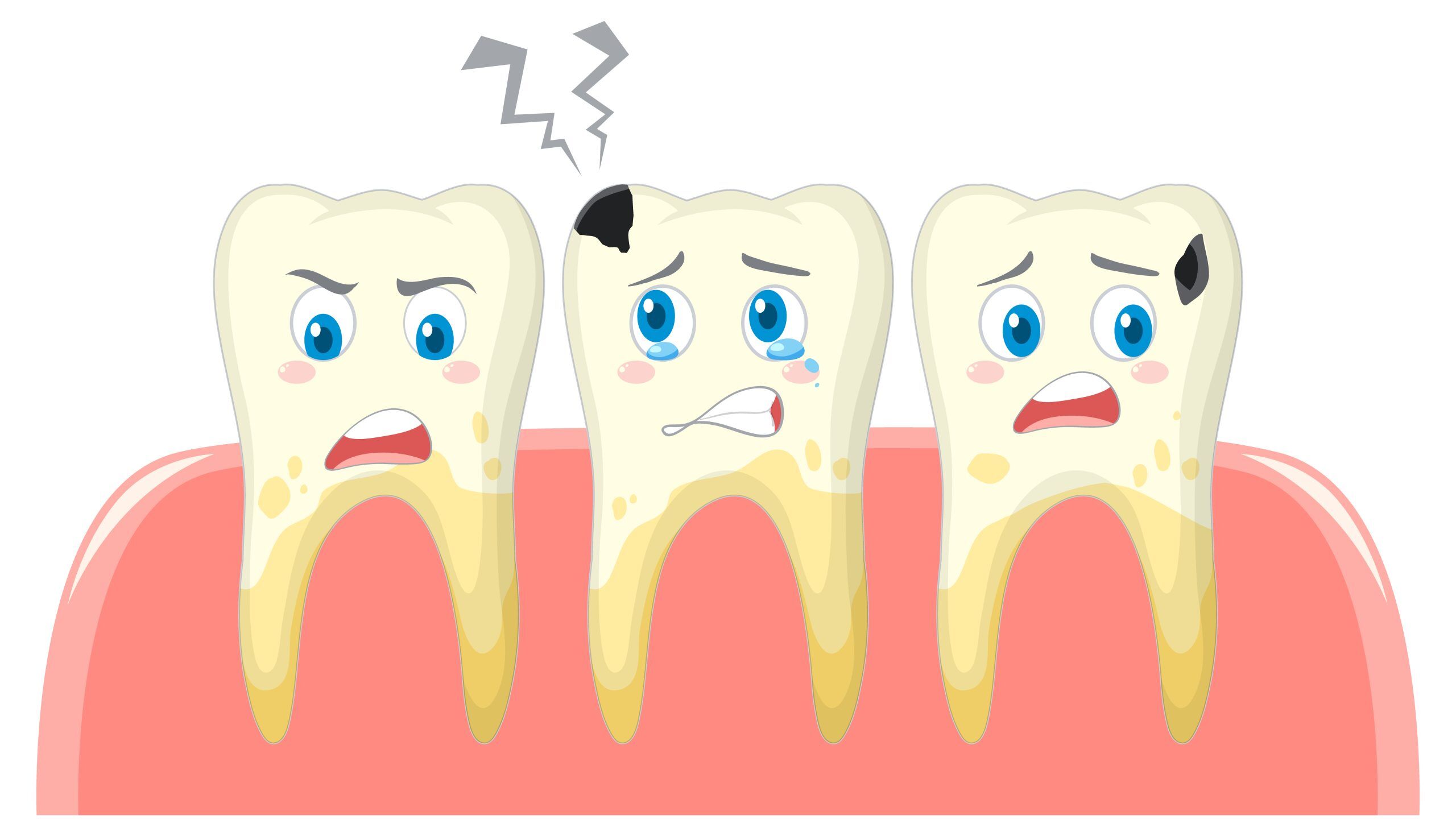 Chipped or Broken Tooth: Signs, Treatment, and Prevention